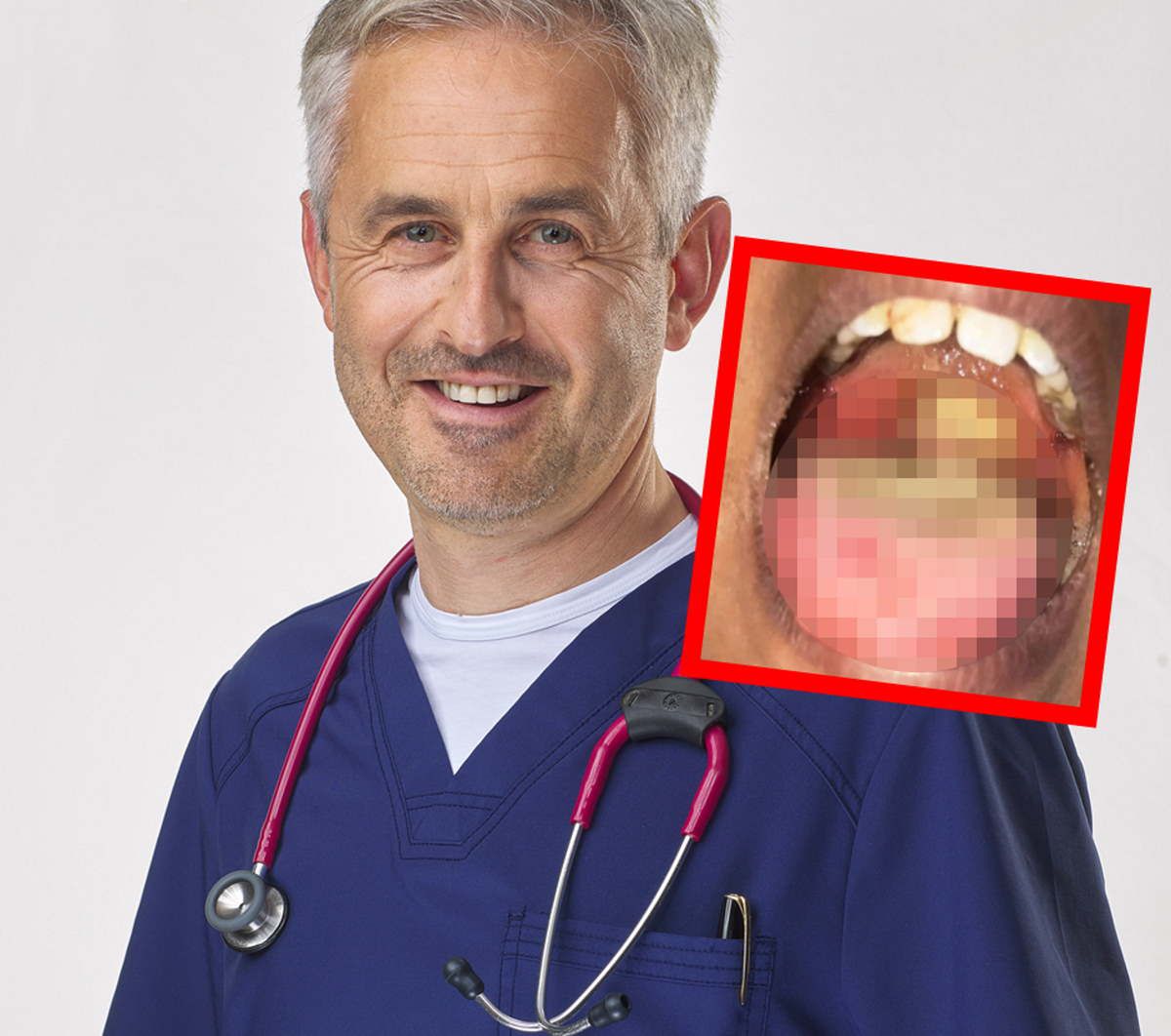 Tak atakuje błonica. Pediatra wylicza objawy choroby