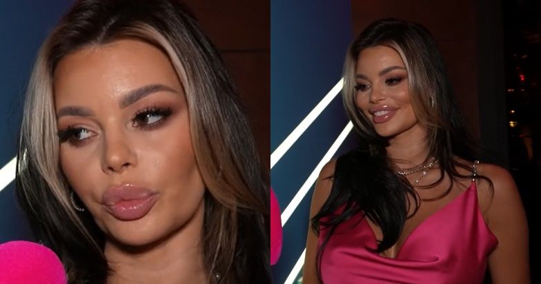 Justyna Gradek Gorąco Poleca Tureckie Operacje Plastyczne To Pionierzy Zabiegów Na Nos Wideo