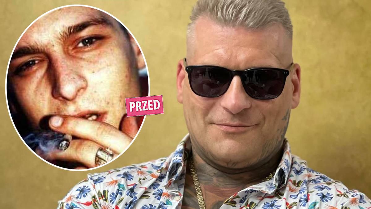 Popek pociął sobie twarz, żeby się "upiększyć". Jak teraz wygląda ...