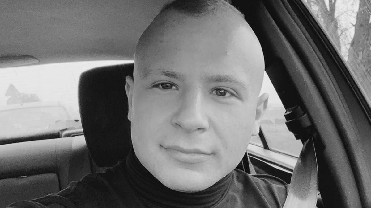 Stifler przeszedł serię operacji plastycznych. Tak wyglądał chwilę po ...