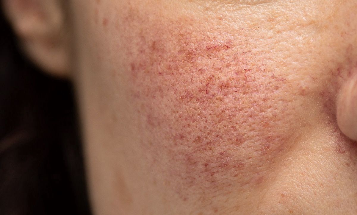 Hidden facial warning sign of liver distress: The subtle symptom you ...