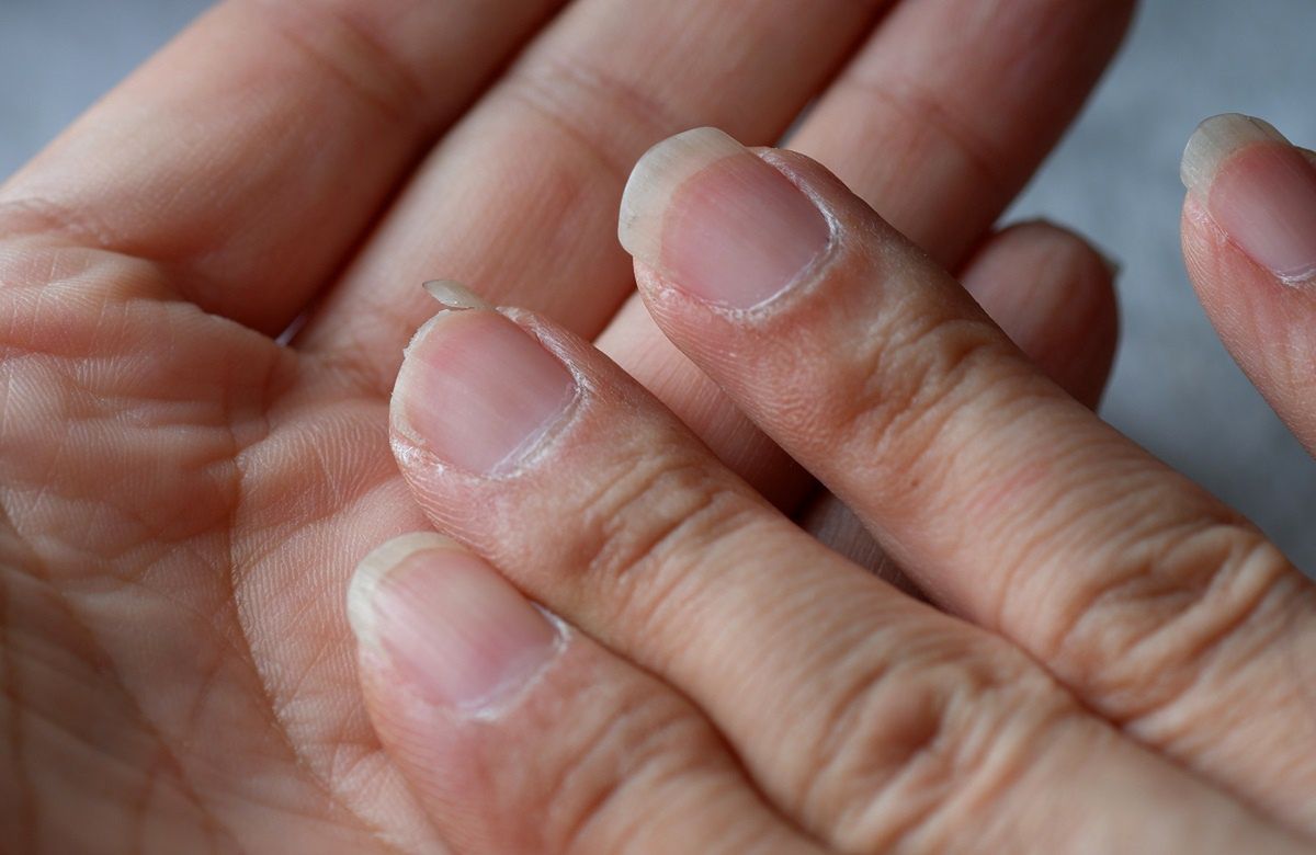 Natural remedies to revive your nails after gel polish