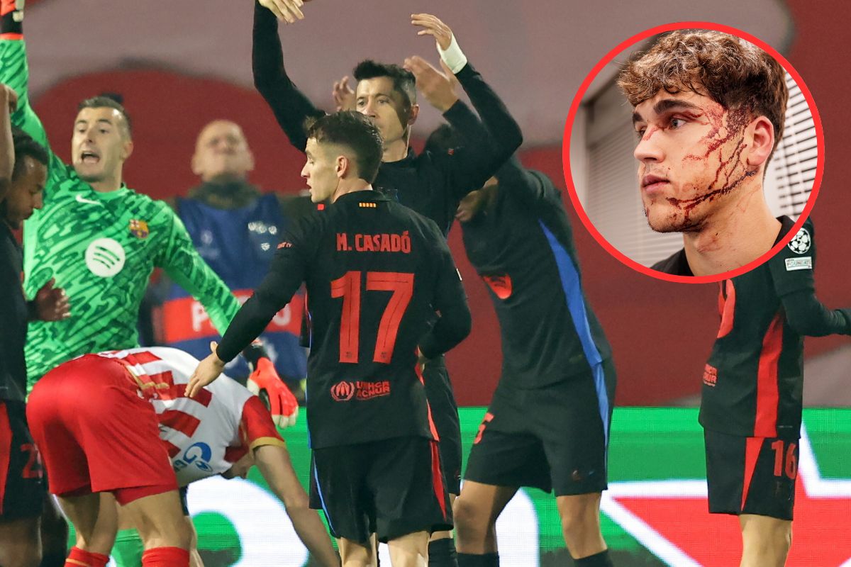 Pau Cubarsi injured in brutal Champions League tackle