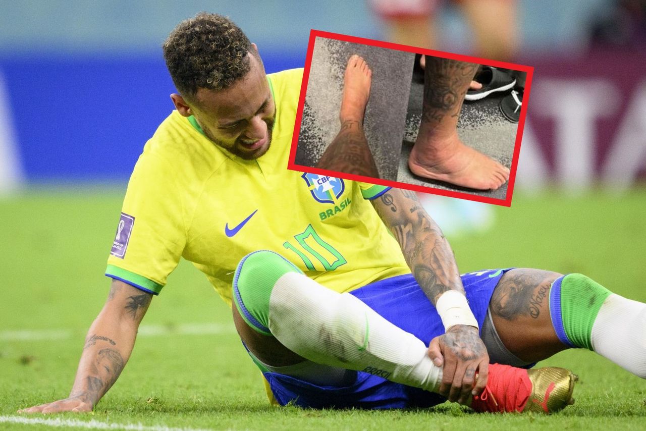 Neymar pokazał nowe zdjęcia po kontuzji. Tak wygląda jego kostka