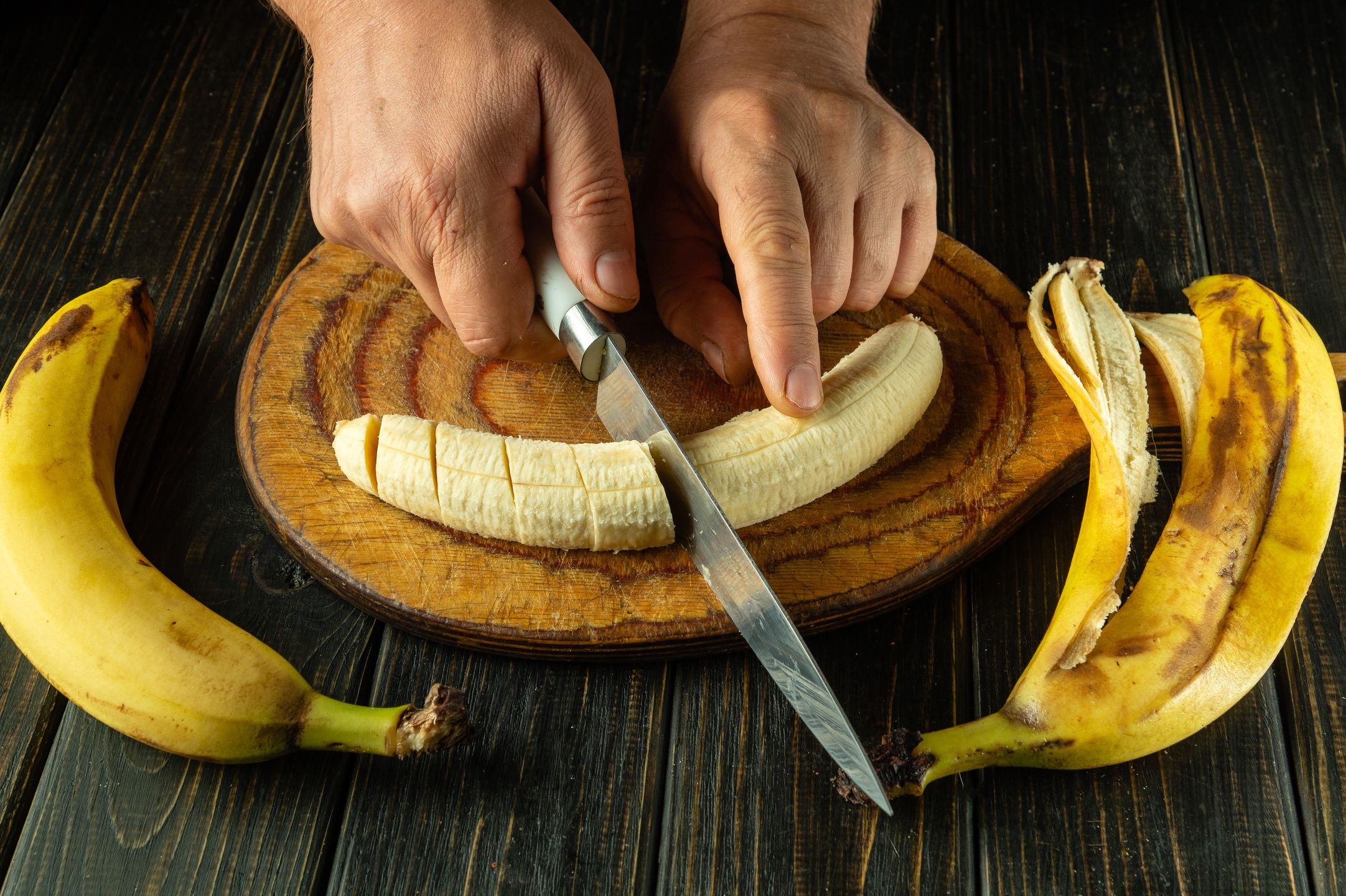 Beware the banana: Potential risks of overindulgence revealed Beware the banana: Potential risks of overindulgence revealed