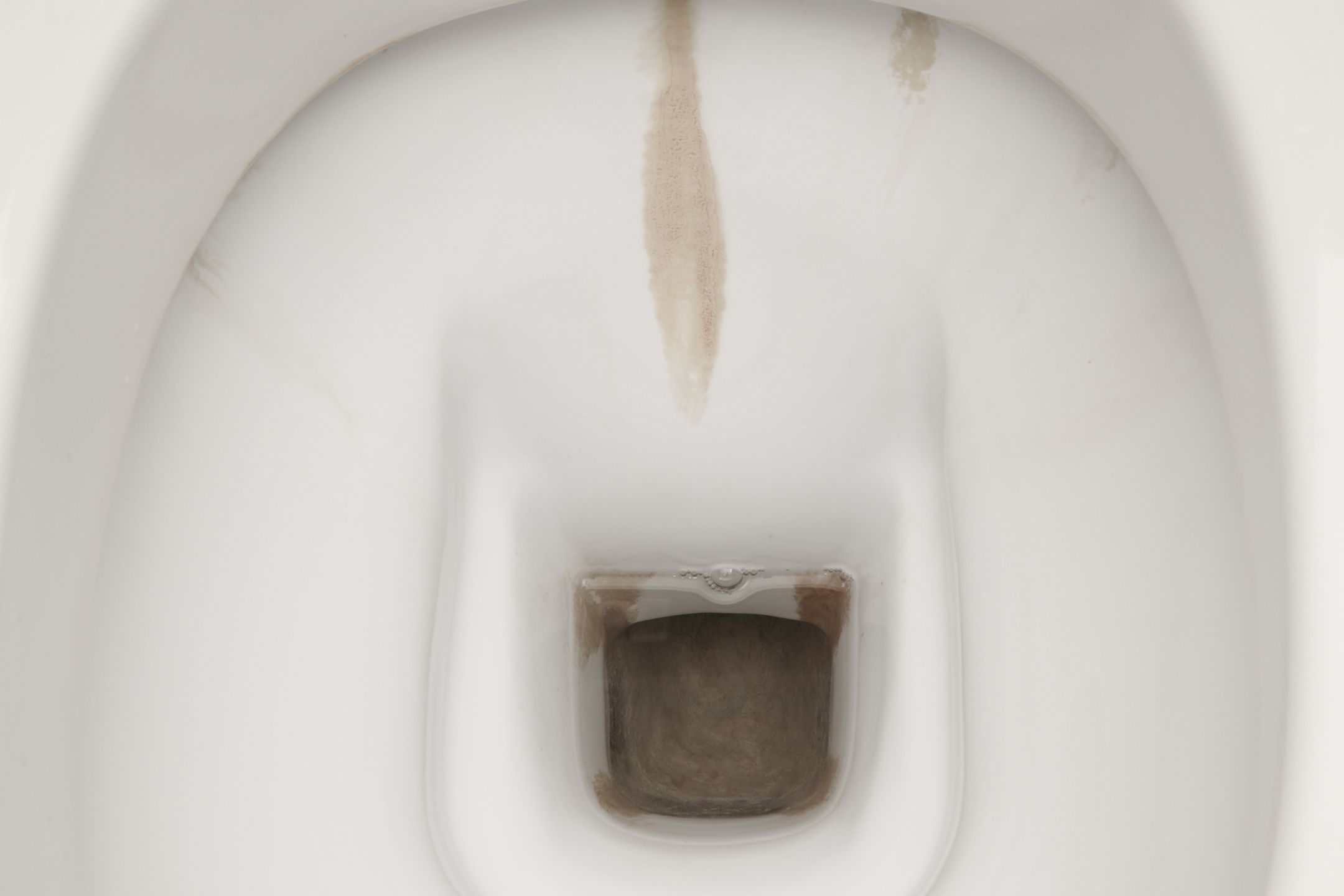 Persistent toilet scale: understanding the causes and learning ...