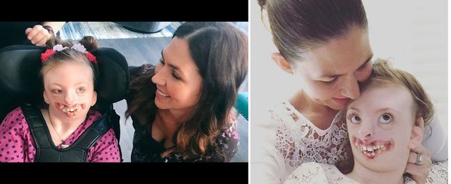 Zdjęcie Sophie Weaver wykorzystano, aby promować aborcję. Dziewczynka ...