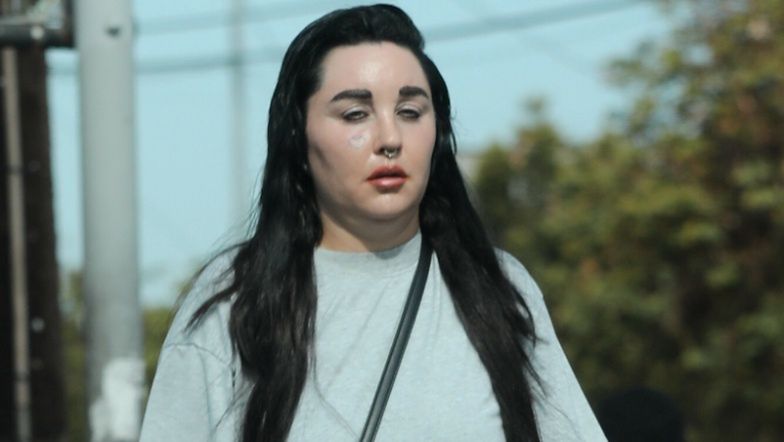 Amanda Bynes: From child star struggles to hopeful recovery