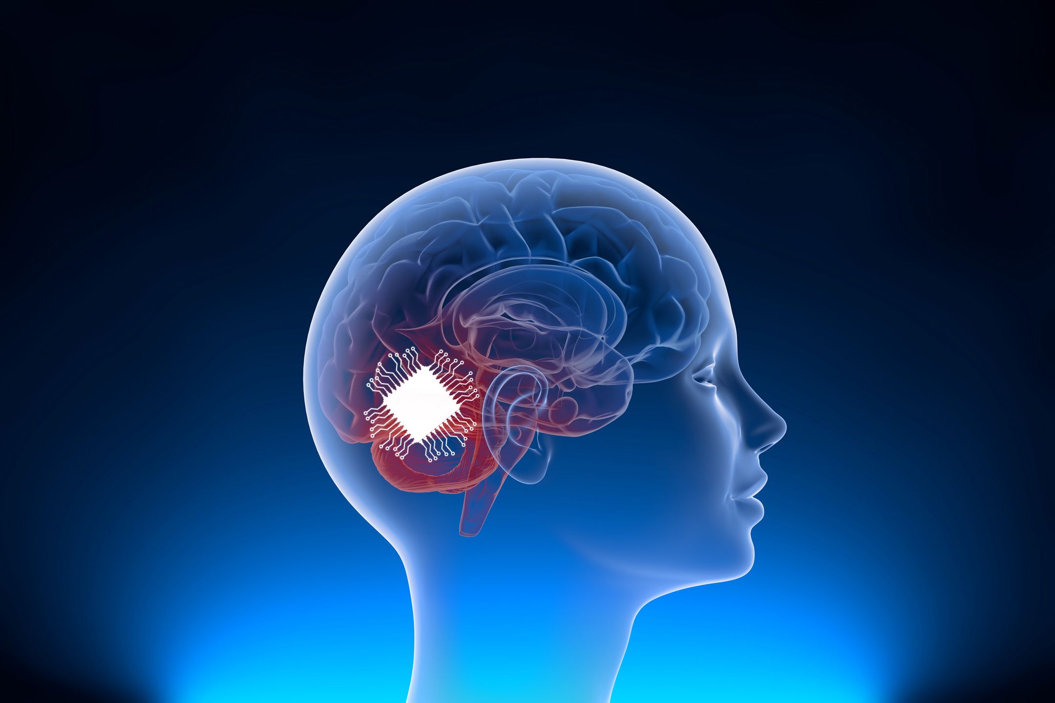 First human gets Neuralink 'Telepathy' brain implant: Sparking new era ...
