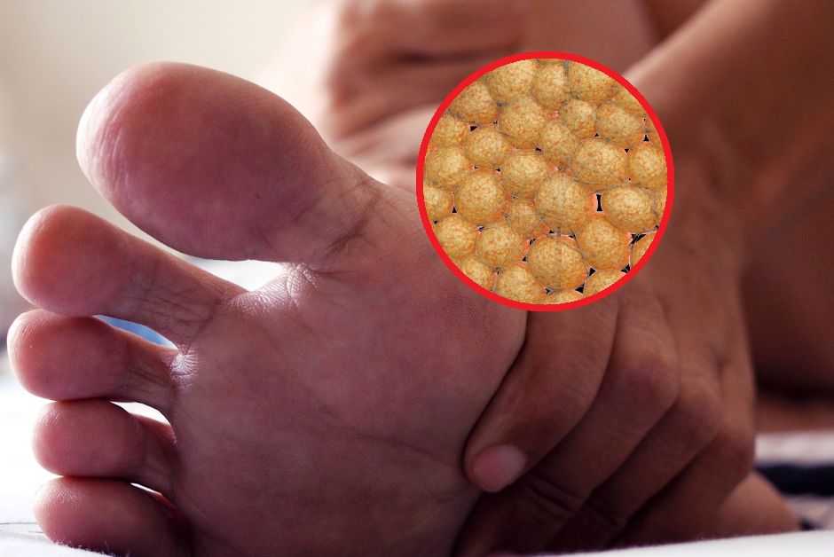 Silent killer: How ignoring these subtle signs of high cholesterol ...