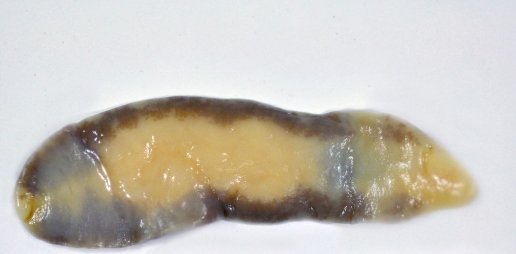 Ciclo De Vida Da Fasciolopsis Buski