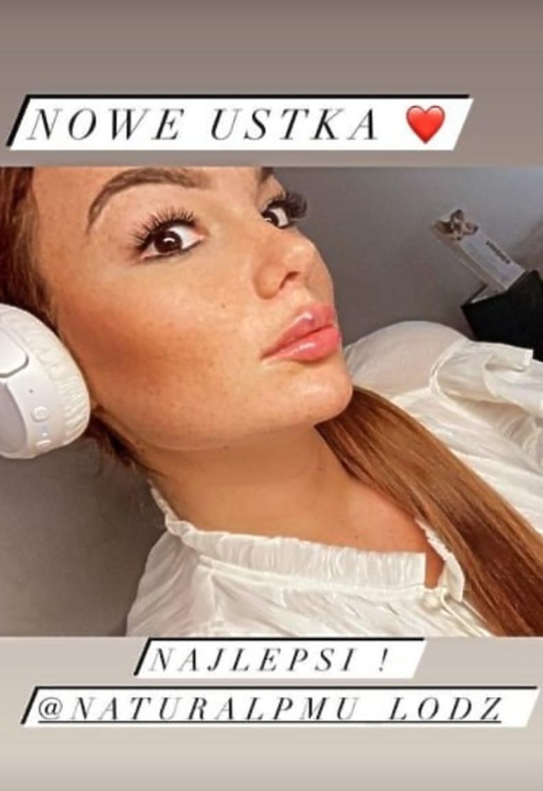 Justyna z "Hotel Paradise" poddała się kolejnej operacji. Pochwaliła ...